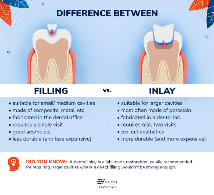10 myths and facts about dental fillings | YourLifeChoices