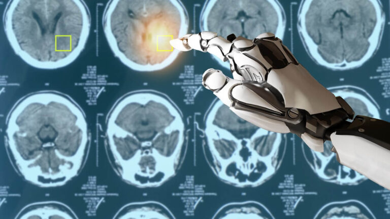 Scientists develop algorithm to detect Parkinson's onset | YourLifeChoices