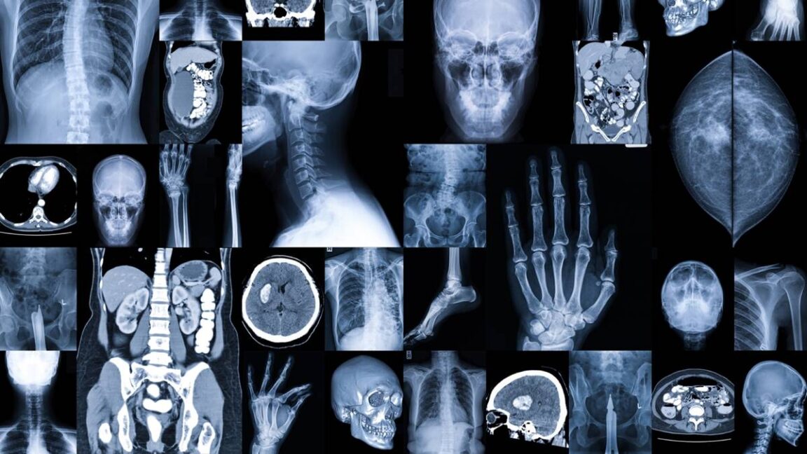 Patients paying huge gap fees for diagnostic imaging | YourLifeChoices