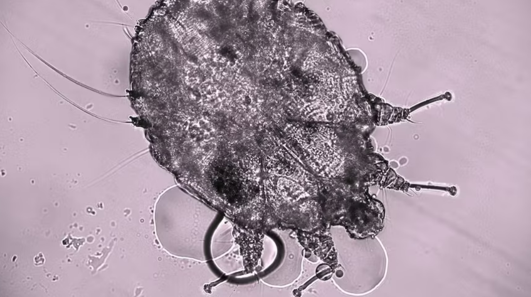 Researchers and biotech firm create new world-first scabies diagnostic ...