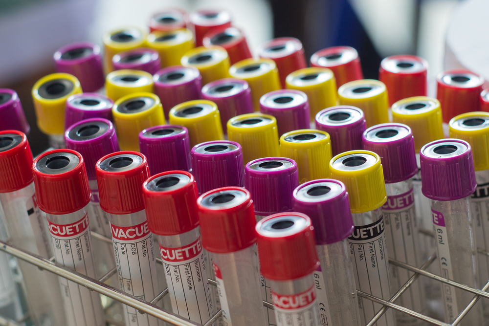 Australian scientists unveil blood test to spot ovarian cancer early ...