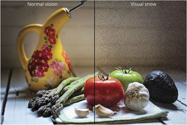 People with this rare visual condition see illusory faces more often ...