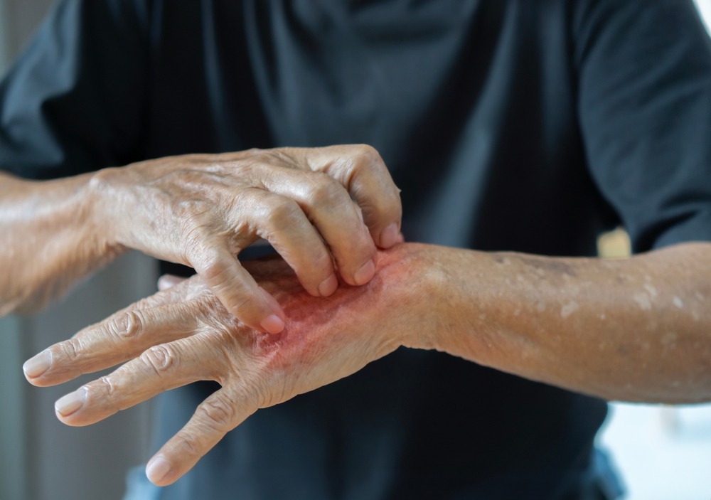 Deadly mosquito virus discovered in Australia—here’s how to stay safe ...