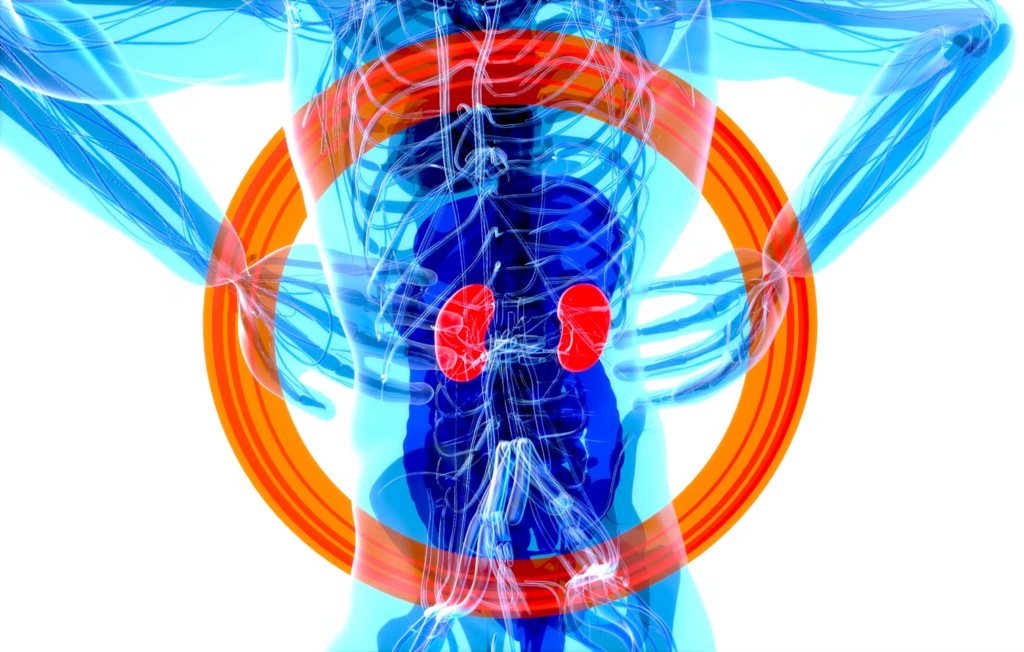 Kidney disease: The silent thief that a million Australians don’t know ...
